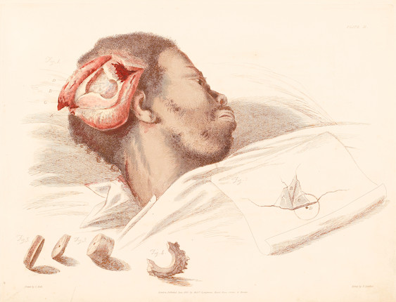 Bonhams : BELL, CHARLES, SIR. 1774-1842. Illustrations of the Great ...