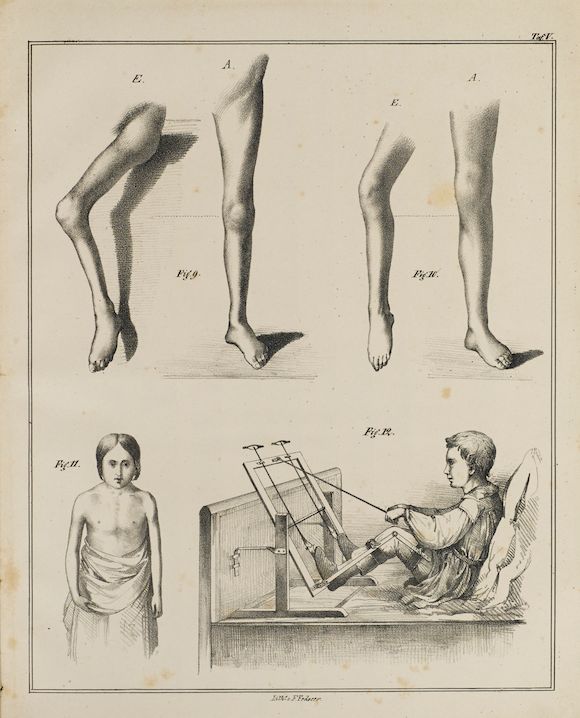 Bonhams : HEINE, JACOB VON. 1800-1879. Beobachtungen über ...