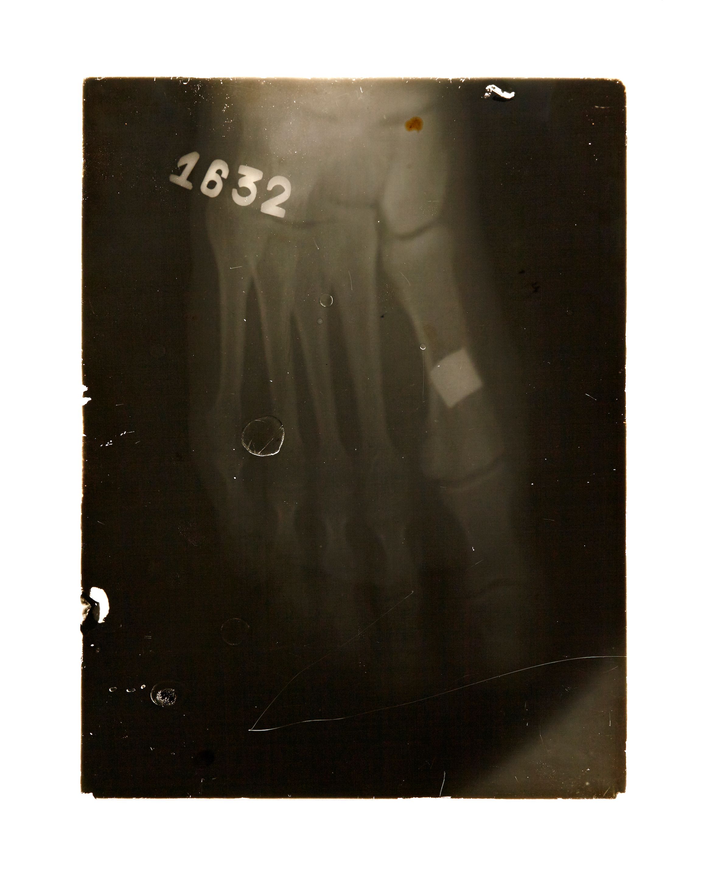 Bonhams : HEMINGWAY, ERNEST. 1899-1961. Three glass negative X-rays and ...