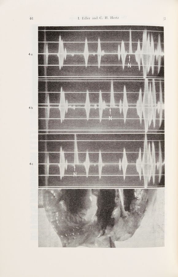 Bonhams : THE INTRODUCTION AND EARLY APPLICATION OF ECHOCARDIOGRAPHY ...