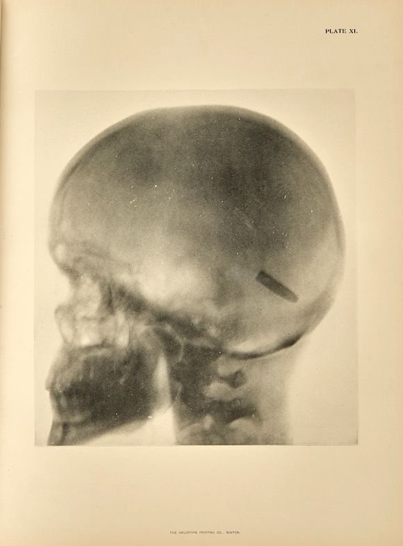 Bonhams : X-RAYS. Borden, William C. 1858-1934. THE USE OF THE ROENTGEN ...