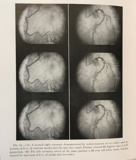 Bonhams : CORONARY ANGIOGRAPHY. SONES, F. MASON JR. 1918-1985; and EARL ...