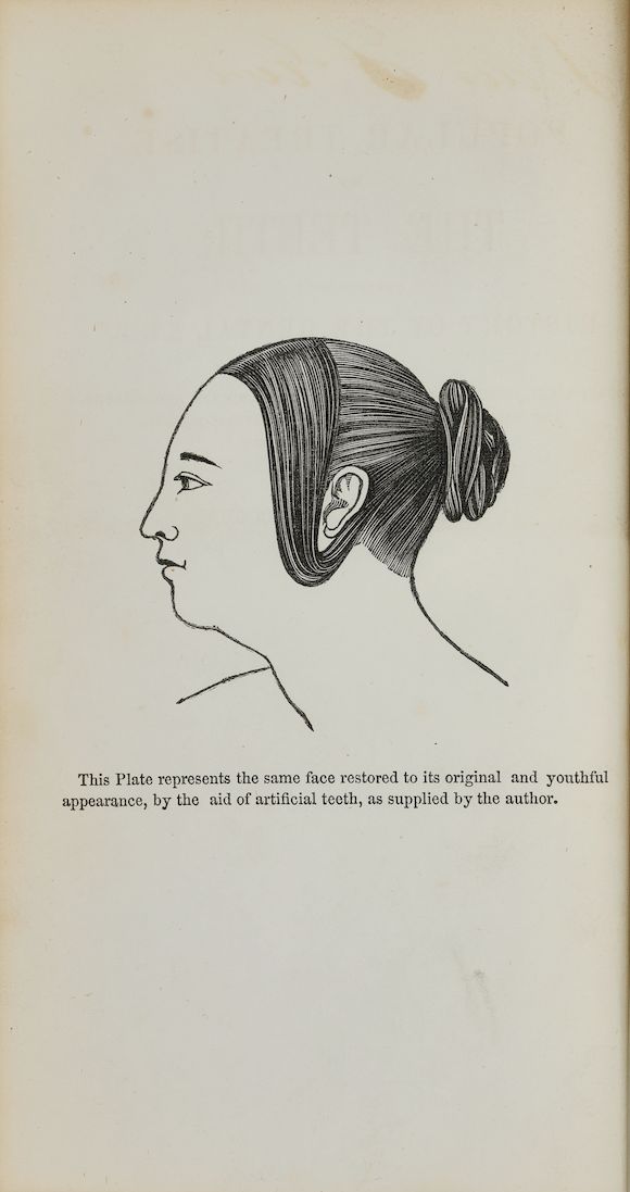 Bonhams : ANESTHESIA PIONEERS. SMITH, MAYO G. 1816-1901. A Popular ...