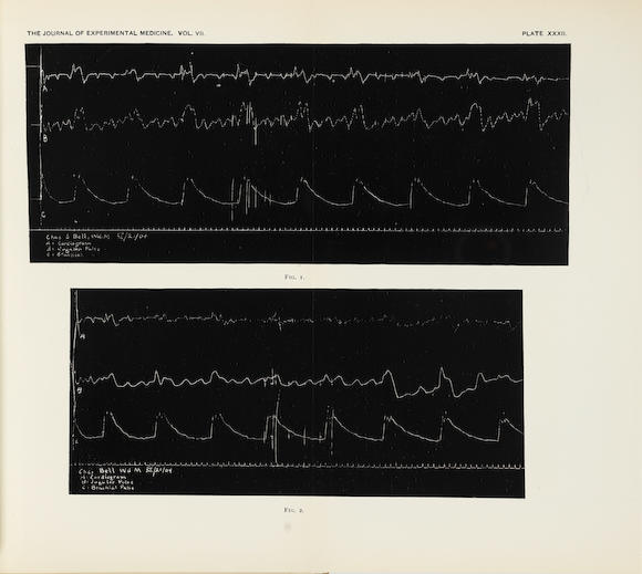 Bonhams Erlanger Joseph 1874 1965 Six Offprints On Cardiac