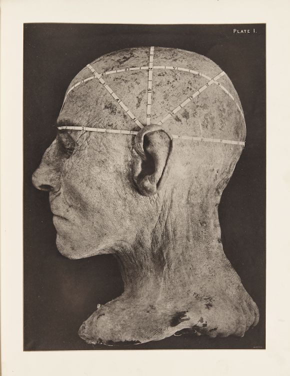 Bonhams : FRASER, ALEC. 1853-1909. A Guide to Operations on the Brain ...