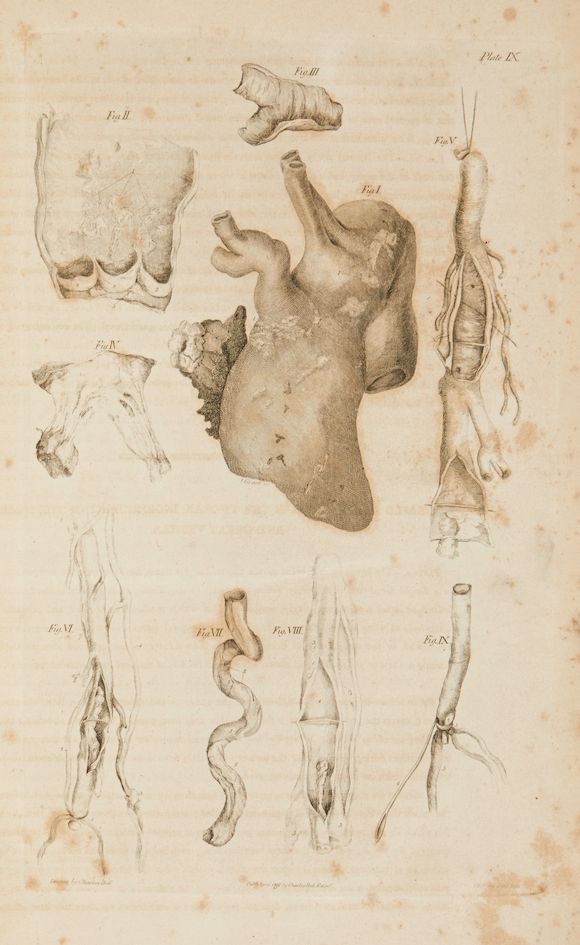 Bonhams : BELL, CHARLES. 1774-1842. A System of Dissections, Explaining ...