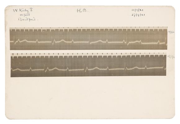 Bonhams : ELECTROCARDIOGRAPHY. LEWIS, THOMAS. 1881-1945. The first ...