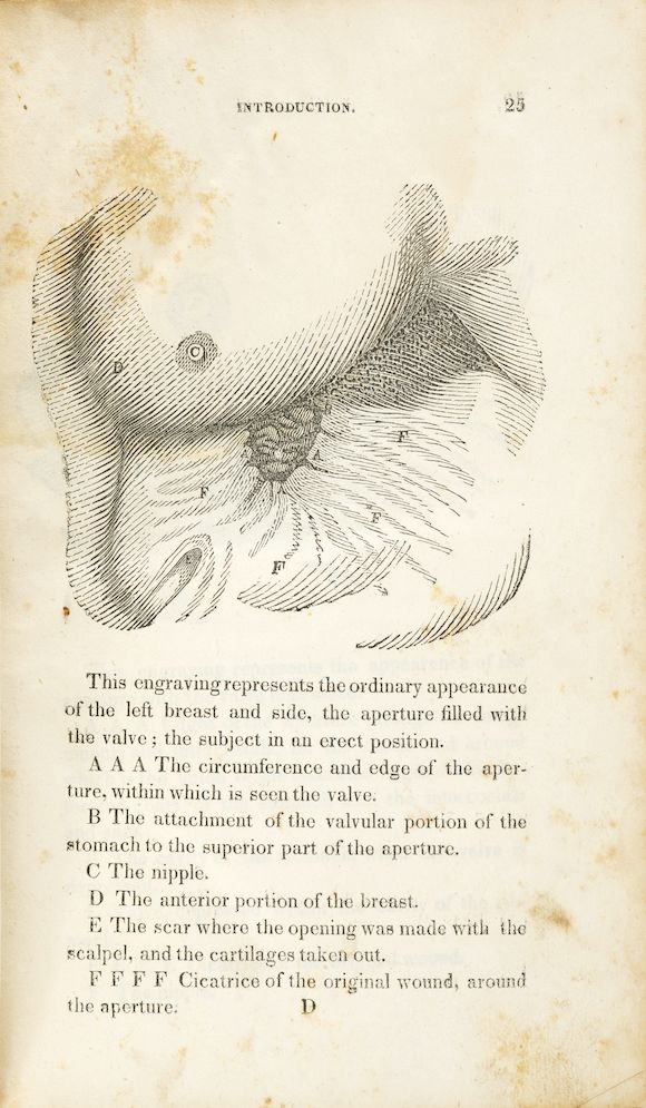 Bonhams : BEAUMONT, WILLIAM. 1785-1853. Experiments and Observations on ...