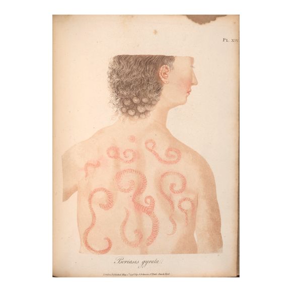 Bonhams : WILLAN, ROBERT. 1757-1812. On Cutaneous Diseases. London: For ...