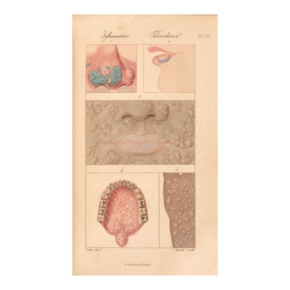 Bonhams : RAYER, PIERRE-FRANÇOIS-OLIVE. 1793-1867. Traite theorique et ...