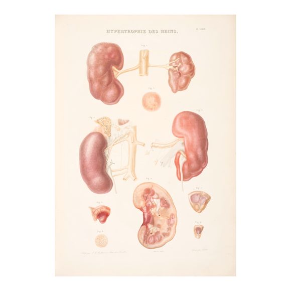 Bonhams : RAYER, PIERRE-FRANÇOIS-OLIVE. 1793-1867. Traité des Maladies ...