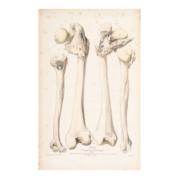 Bonhams : DELESTRE, JEAN-BAPTISTE. 1800-1871. Iconographie pathologique ou collection de faits ...