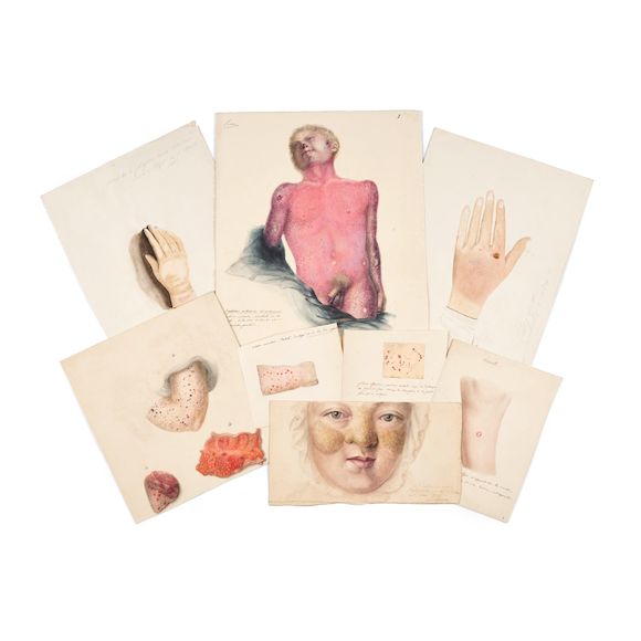 Bonhams : SUPERB COLLECTION OF DERMATOLOGICAL WATERCOLORS AND ...